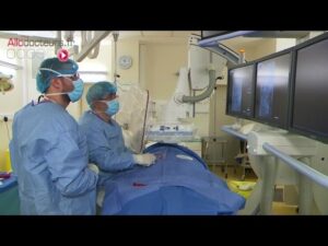 Varicocele Grados 3: Síntomas, Tratamiento y Efectos en la Salud ...